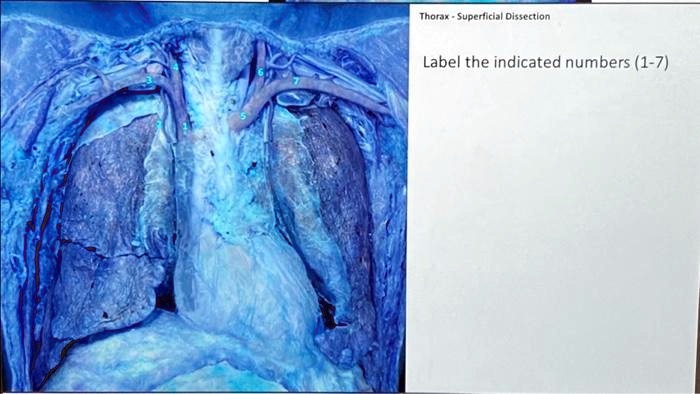 Thorax - Superficial Dissection Label the indicated numbers (1-7)