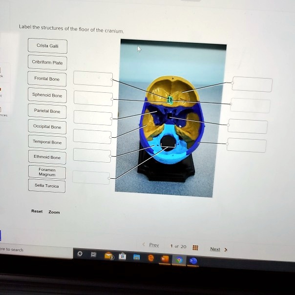Label the structures of the floor of the cranium. Crista Gal Cribriform Plate Frontal Bone ...