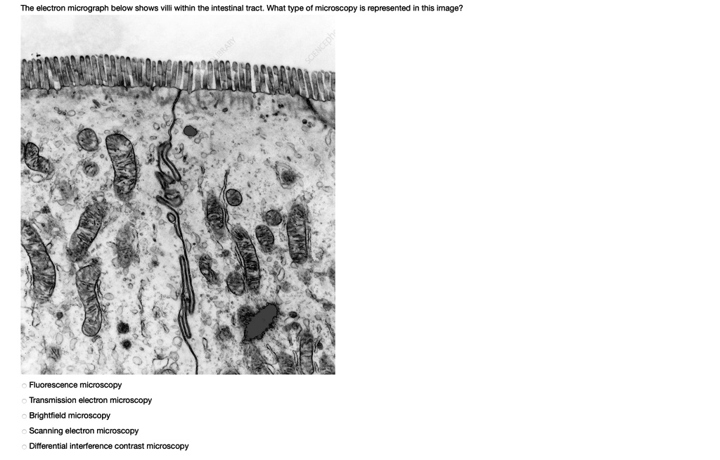 the electron micrograph below shows villi within the intestina tract ...
