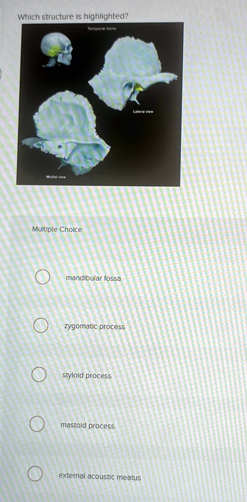 Which structure is highlighted? Temporal bone Multiple Choice ...