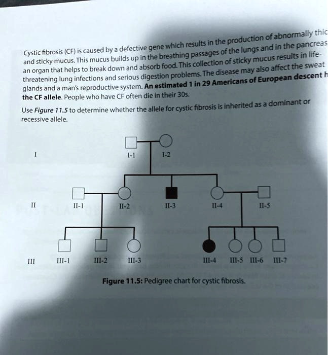 SOLVED: Cystic fibrosis (CF) is caused by a defective gene which ...