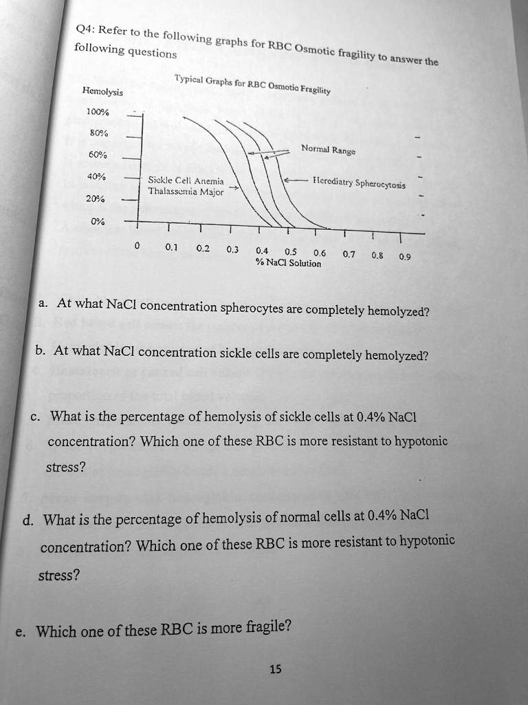 SOLVED: Following questions Q4: Refer to the following graphs for RBC ...