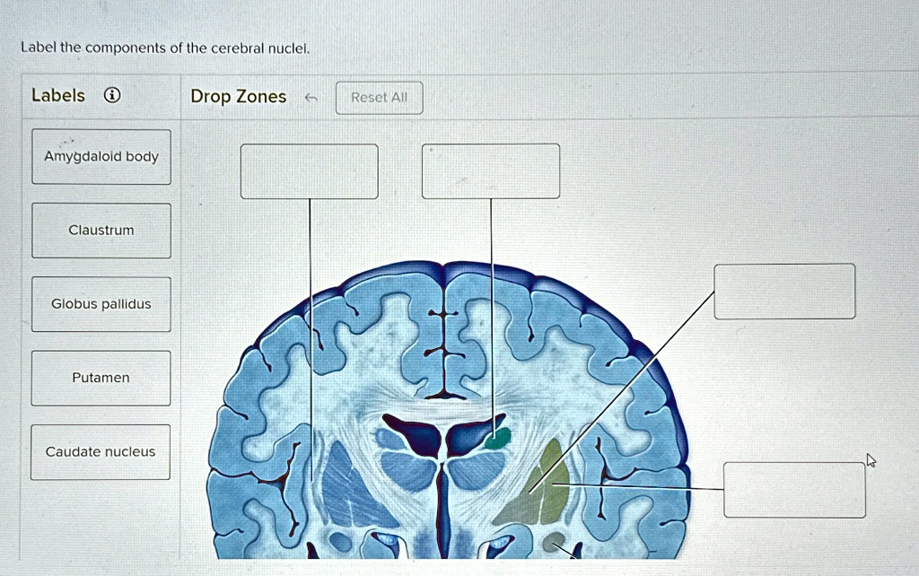 Label the components of the cerebral nuclei. Labels Amygdaloid body ...