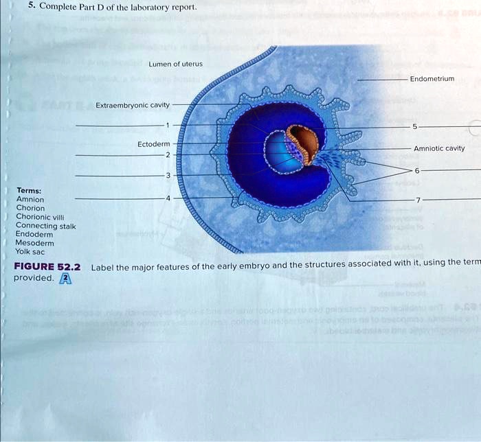 SOLVED: 5.Complete Part D of the laboratory report Lumen of uterus ...