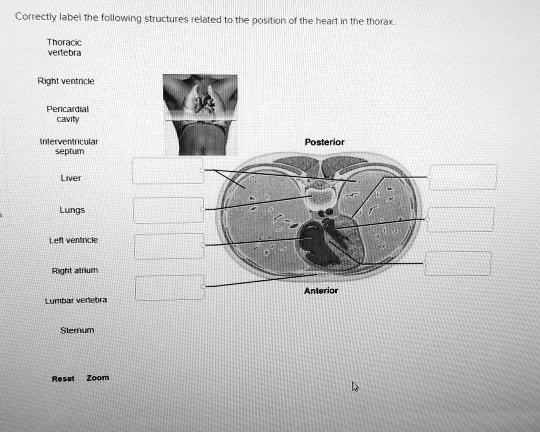 SOLVED: Correctly label the following structures related to the position of the heart in the ...