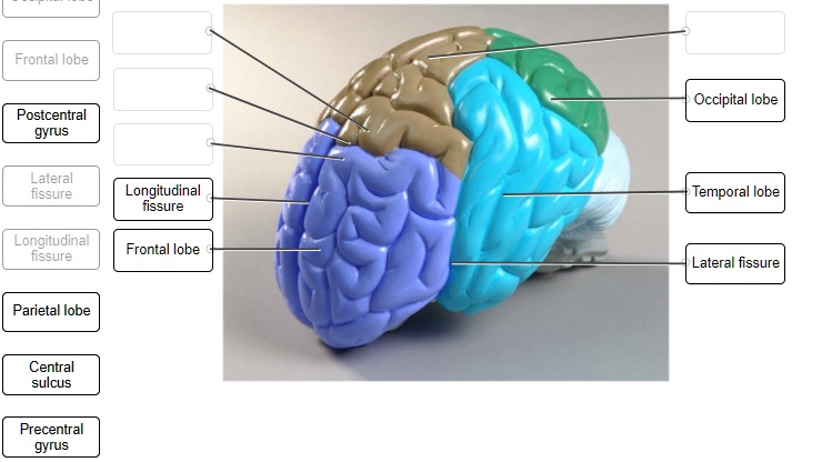 SOLVED: Identify the structures on this lateral view of a brain model ... SOLVED: Identify the structures on this lateral view of a brain model ...