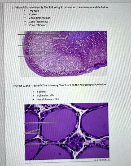 SOLVED: Text: Adrenal Gland - Identify the following structures on the ...