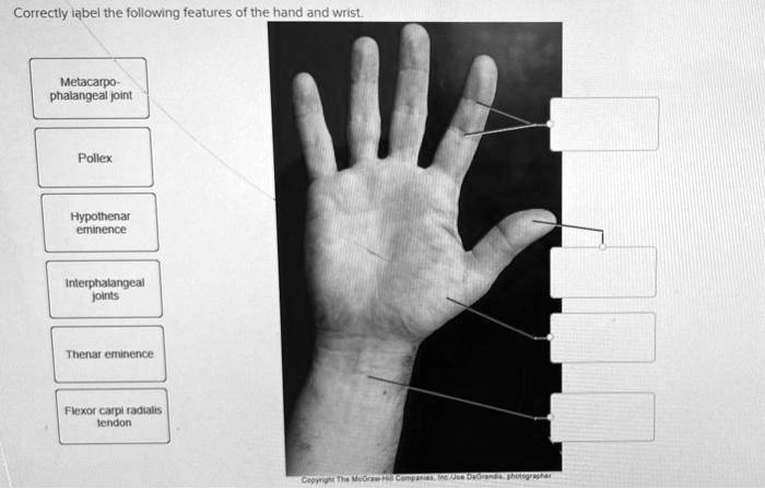 SOLVED: Please correctly label the following features of the hand and ...