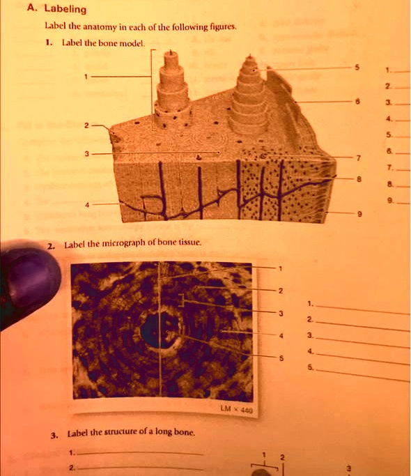 SOLVED: Texts: A. Labeling: Label the anatomy in each of the following ...