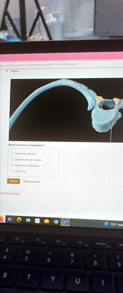 Part A Which structure is highlighted? transverse process superior ...