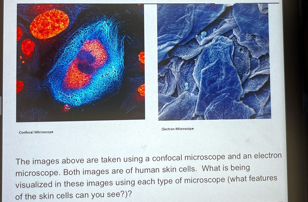 Confocal Microscope Electron Microscope The images above are taken ...