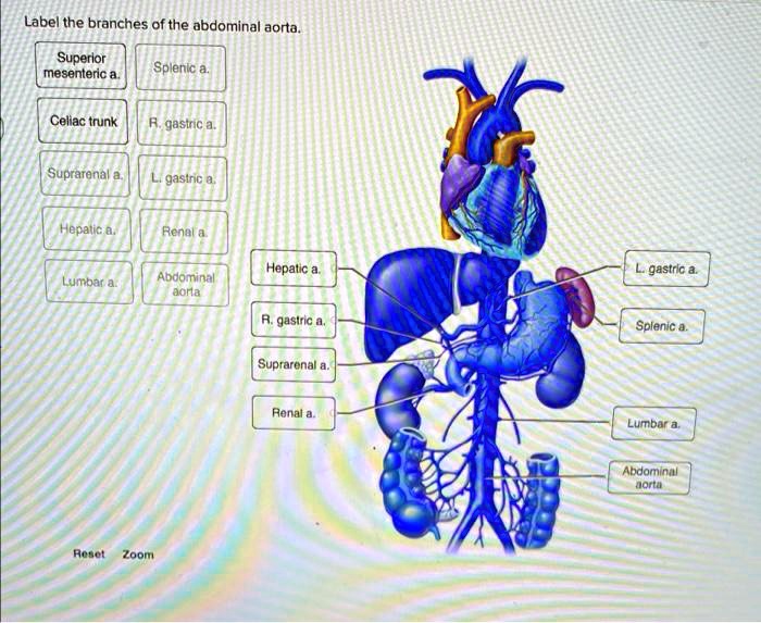 SOLVED: Label the branches of the abdominal aorta: - Superior ...