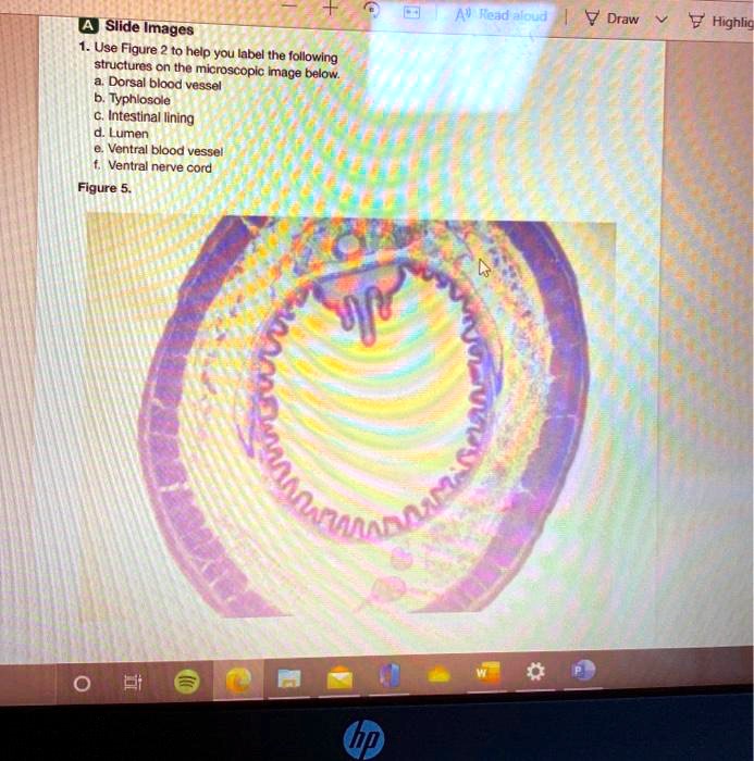 SOLVED: Slide Images Use Flgure help you label the following structures ...