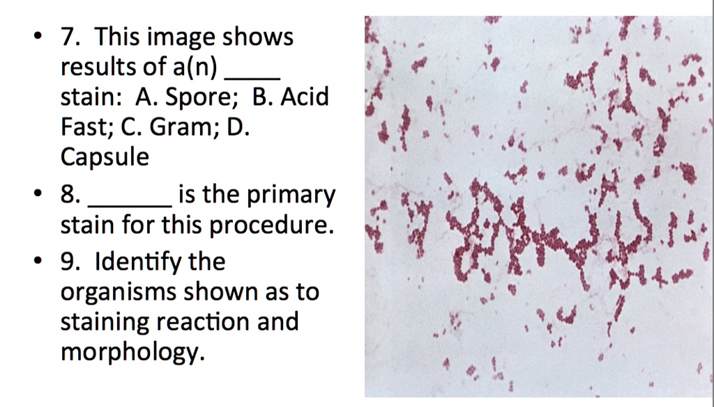 SOLVED: 7. This image shows results of a(n) stain: A. Spore; B. Acid ...