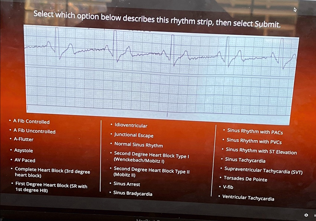 SOLVED: What rhythm is this? Select which option below describes this ...