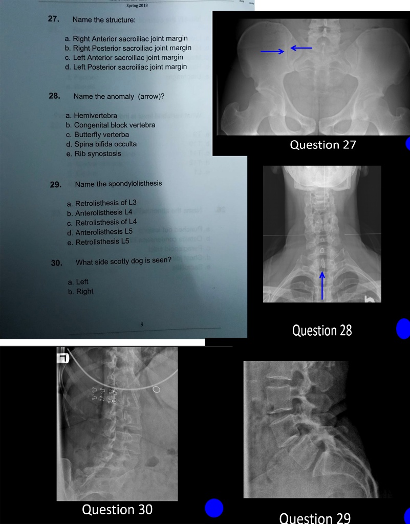 SOLVED: Spring 2018 27. Name the structure: a. Right Anterior ...