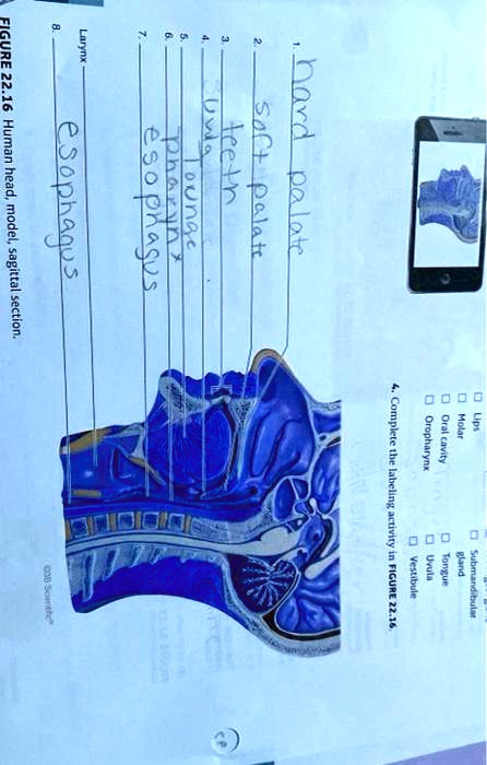Larynx Uvula esophagus esophagus one teeth Soft palate hard palate ...