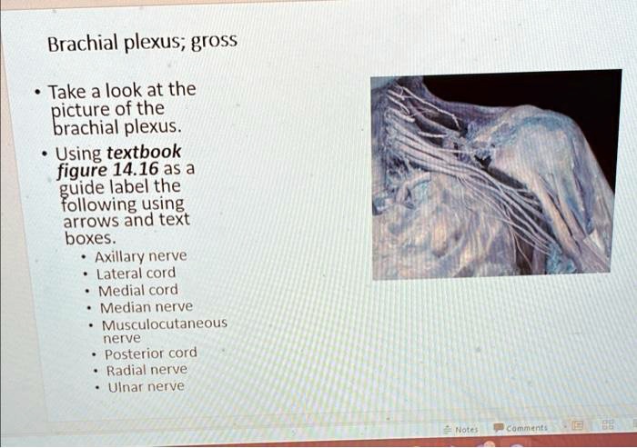 I need it labeled with listed names. Brachial plexus; gross Take a look ...