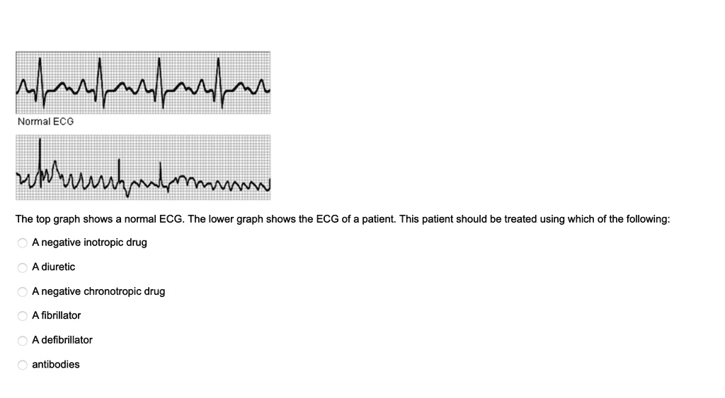 Solved The Top Graph Shows A Normal Ecg The Lower Graph Shows The Ecg Of A Patient This 