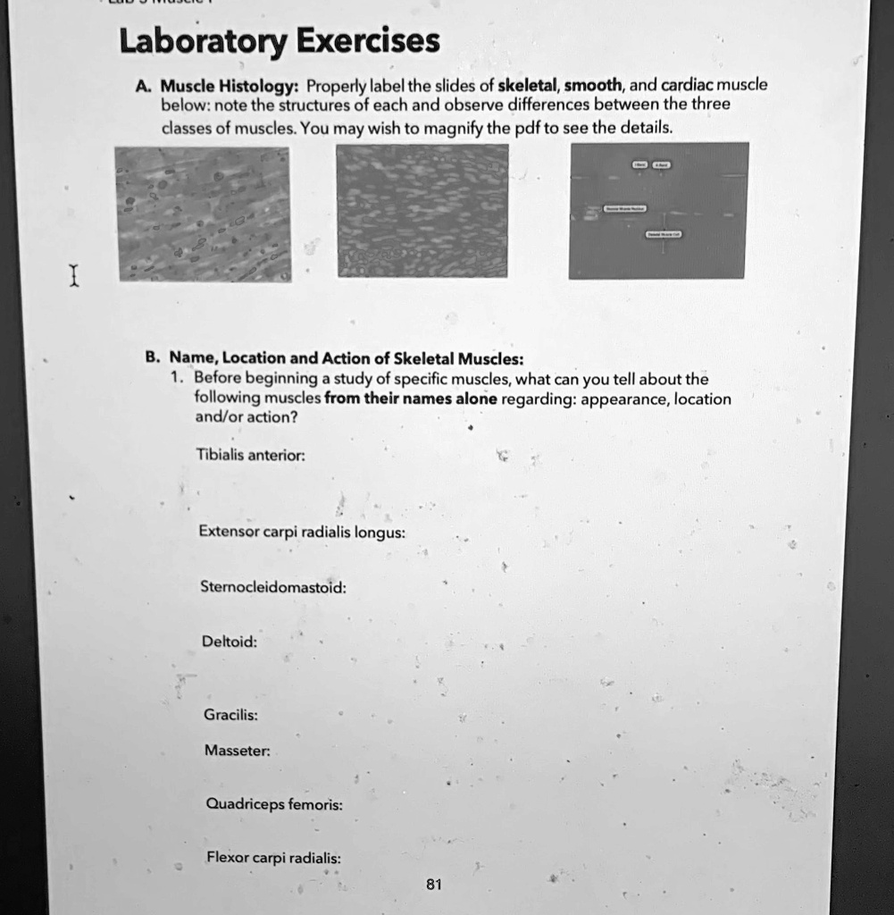 SOLVED: Laboratory Exercises: Muscle Histology Properly label the ...