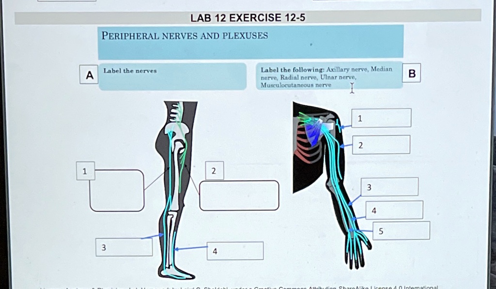 SOLVED: LAB 12 EXERCISE 12-5 PERIPHERAL NERVES AND PLEXUSES Label the ...