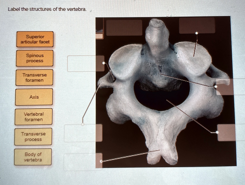 Label the structures of the vertebra. Superior articular facet Spinous process Transverse ...