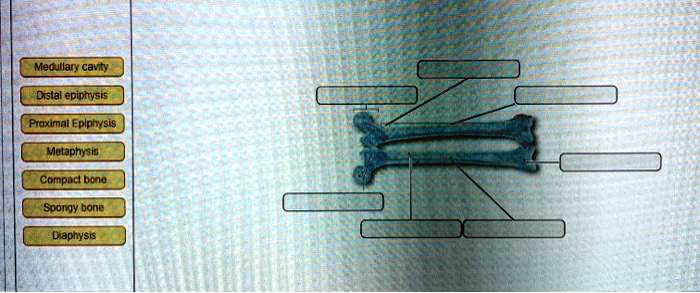 SOLVED: Medullary cavity Distal epiphysis Proximal epiphysis Metaphysis ...