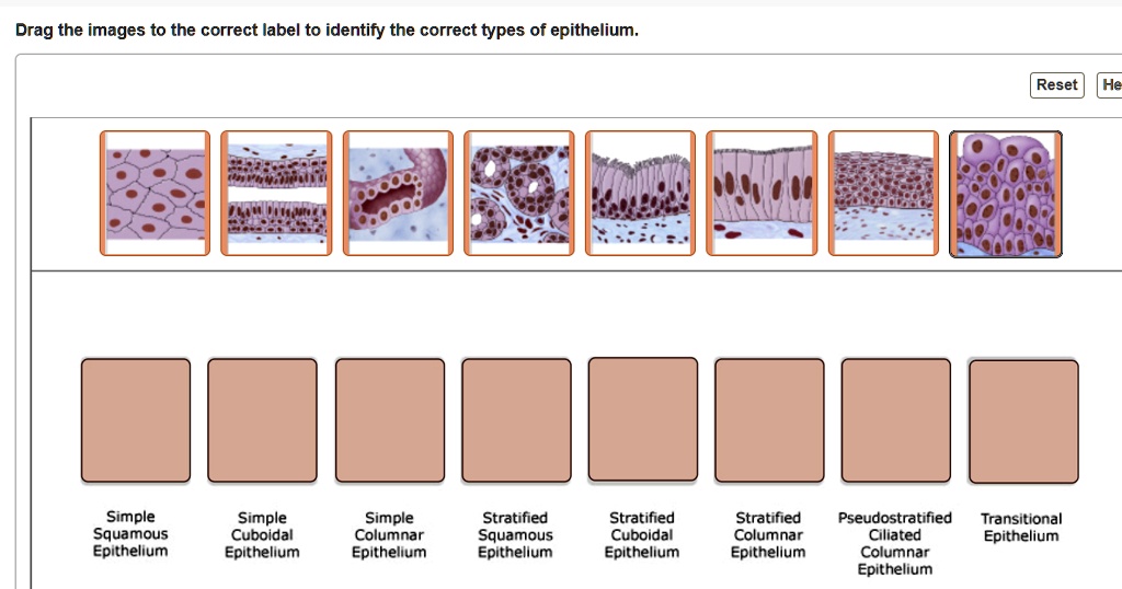 drag the images to the correct label to identify the correct types of ...