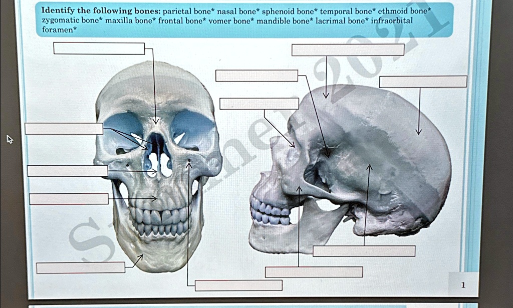 identify the following bones parietal bone nasal bone sphenoid bone ...