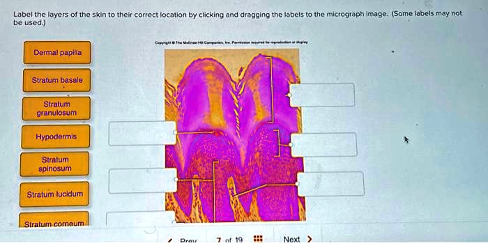 Label the layers of the skin to their correct location by clicking and ...