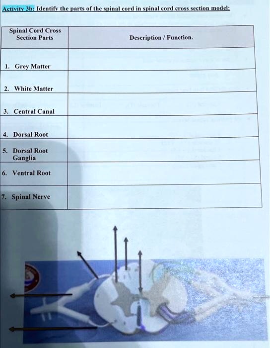 SOLVED: Activity 3h: Identify the parts of the spinal cord in the spinal cord cross-section ...