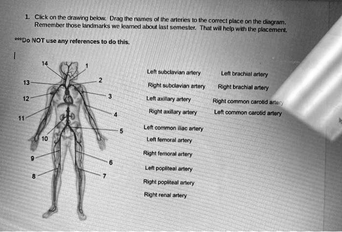 SOLVED: Click on the drawing below. Drag the names of the arteries to the correct place on the ...