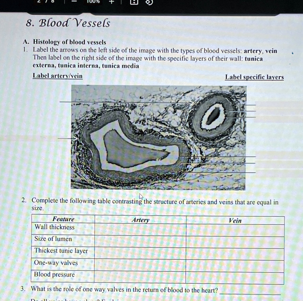 SOLVED: Title: Blood Vessels: Histology and Structure of Arteries and Veins Tissue LLJJ 0 8 ...