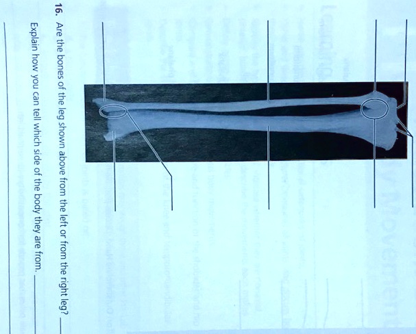 16. Are the bones of the leg shown above from the left or from the ...