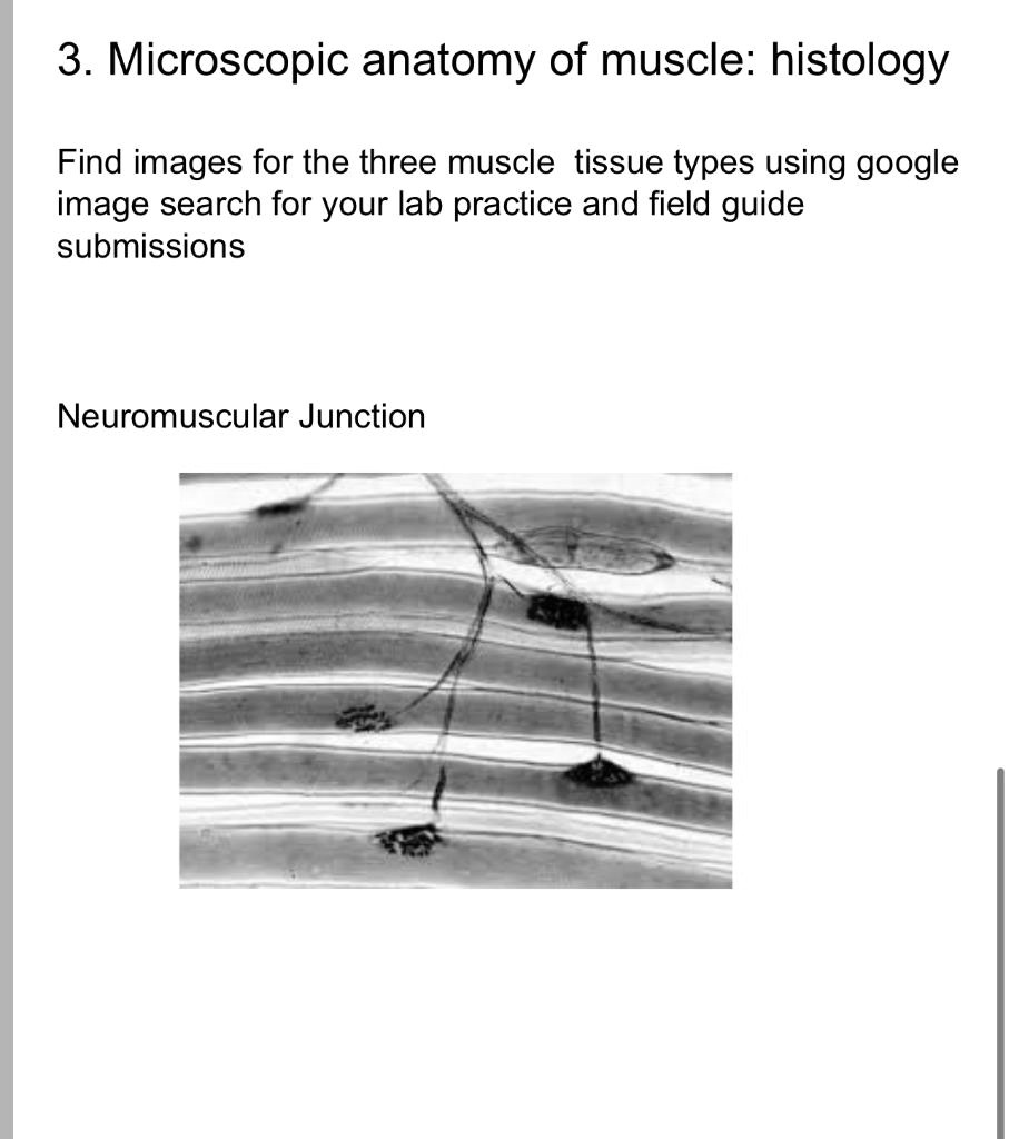 SOLVED: 3. Microscopic anatomy of muscle: histology Find images for the ...