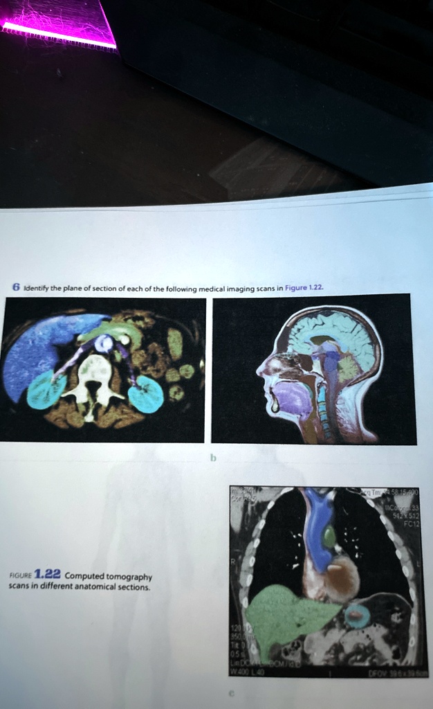 6 Identify the plane of section of each of the following medical ...