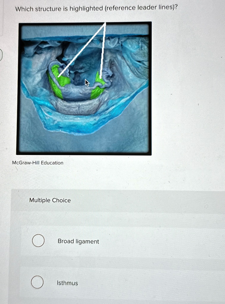 Which structure is highlighted (reference leader lines)? McGraw-Hill Education Multiple Choice ...
