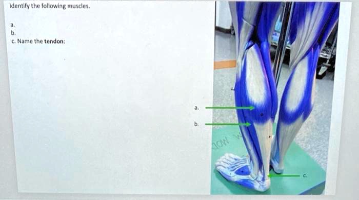 Identify the following muscles: A, B, and C. Name the tendon.
