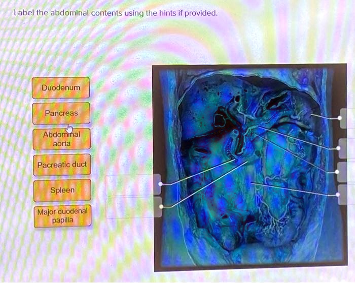 [GET ANSWER] label the abdominal contents using the hints if provided duodenum pancreas ...