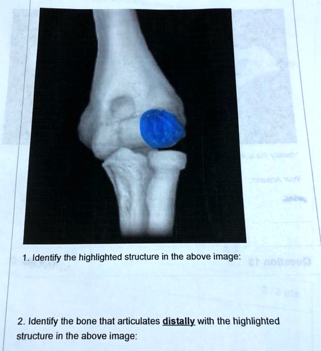 SOLVED:1. Identify the highlighted structure in the above image: 2 ...