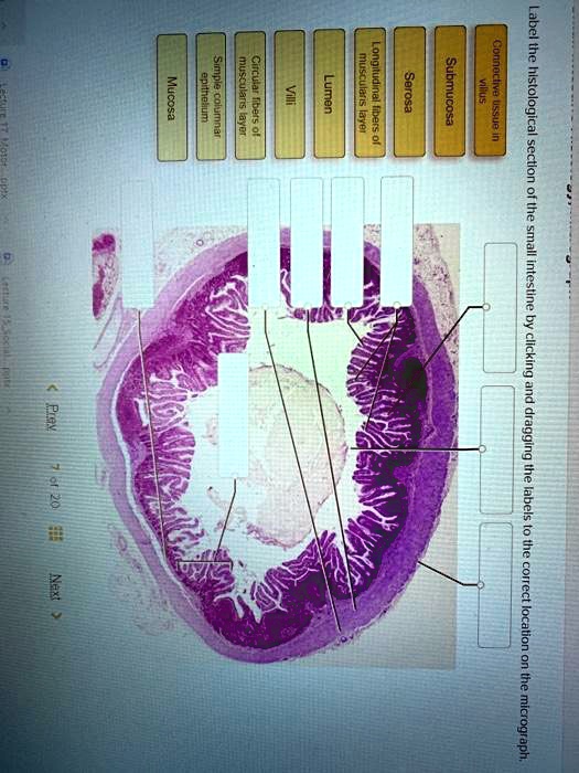 Label the histological section of the small intestine by clicking and ...