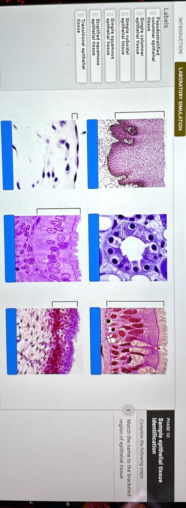 SOLVED: INTRODUCTION LABORATORY SIMULATION Labels: Pseudostratified columnar epithelial tissue ...