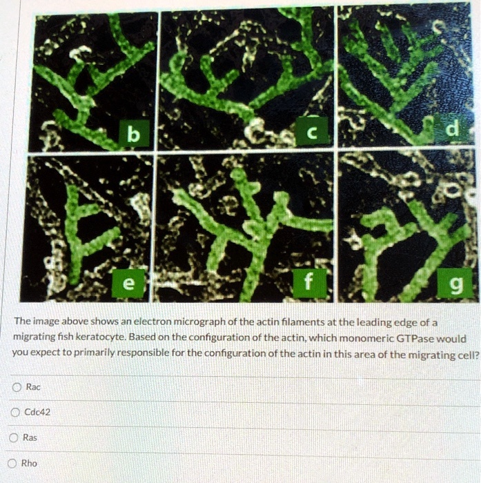 SOLVED: The image above shows an electron micrograph of the actin ...