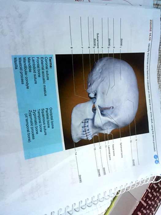 SOLVED: 1 Sutna ] 1 Maxilla Mastoid / Mandibular condyle VHN Lambdoid ...