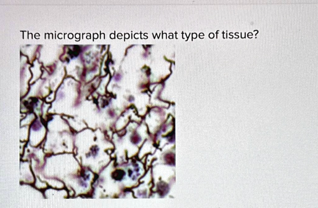 SOLVED: The micrograph depicts what type of tissue? The micrograph ...