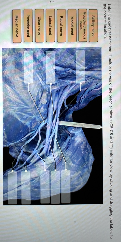 Label the cadaver neck and shoulder nerves of the brachial plexus (C5 ...