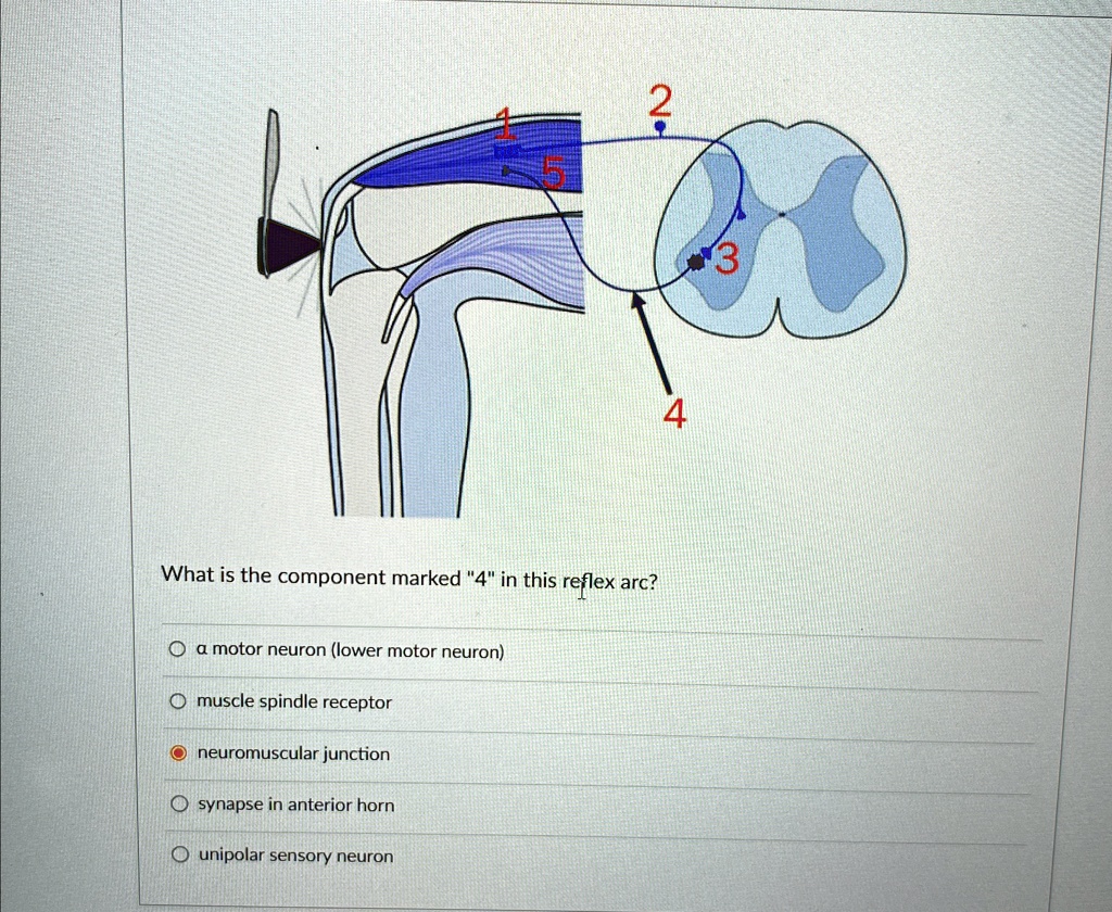 21 3 4 what is the component marked 4 in this reflex arc a motor neuron ...