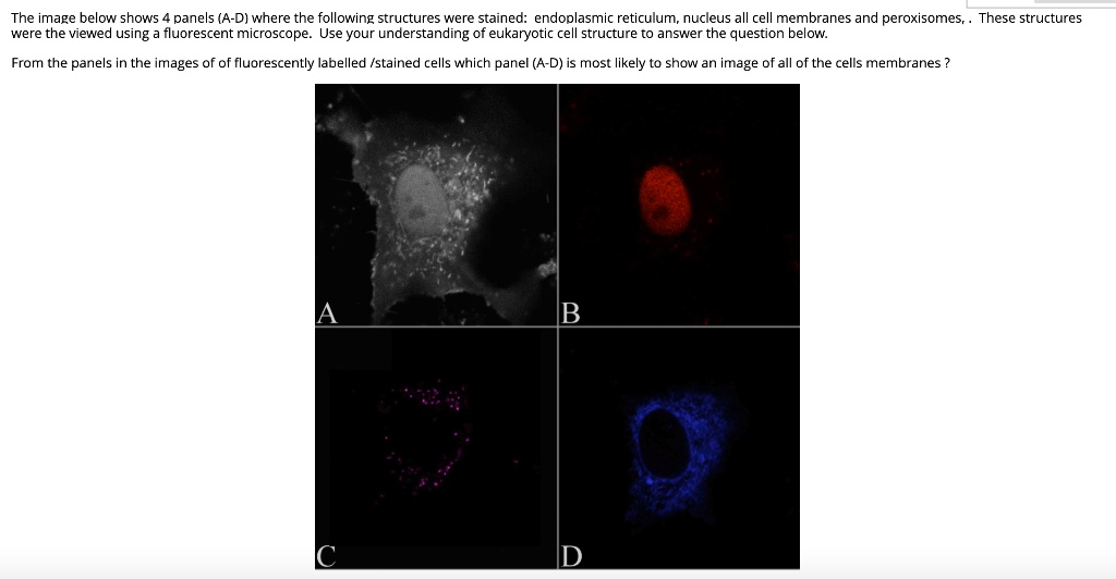 The image below shows 4 panels (A-D) where the following structures were stained: endoplasmic ...