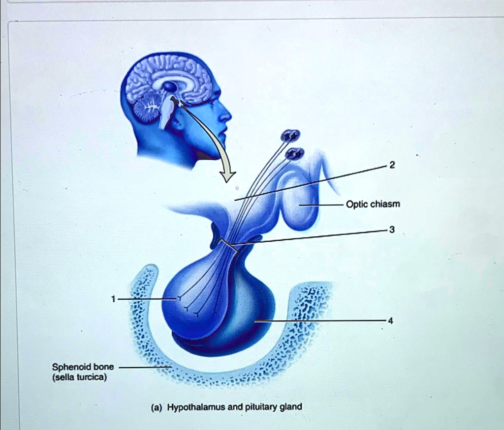 1 Sphenoid bone (sella turcica) (a) Hypothalamus and...
