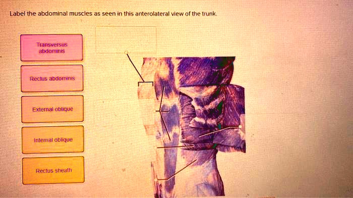 Label the abdominal muscles as seen in this anterolateral view of the ...